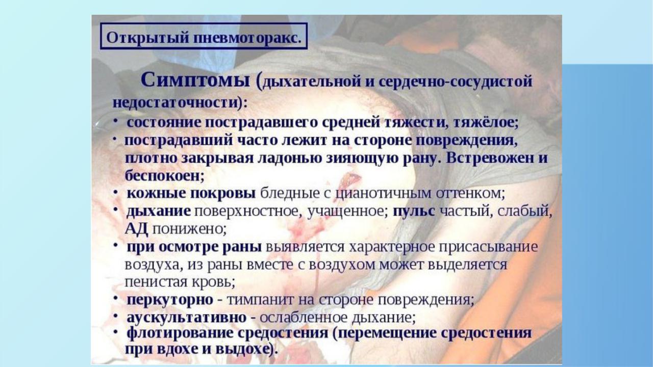 Презентация на тему: При открытом пневмотораксе