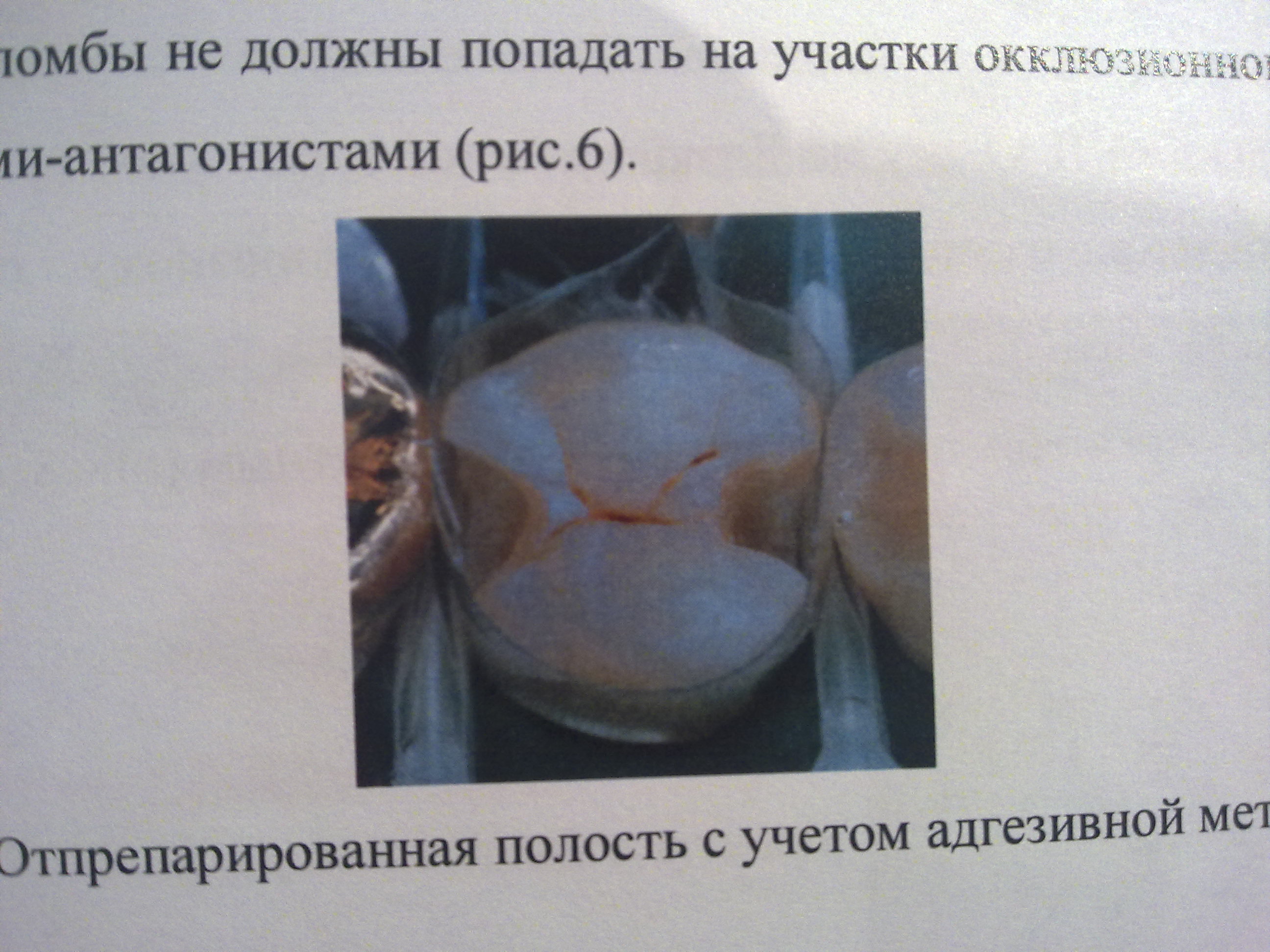 Методика препарирования.