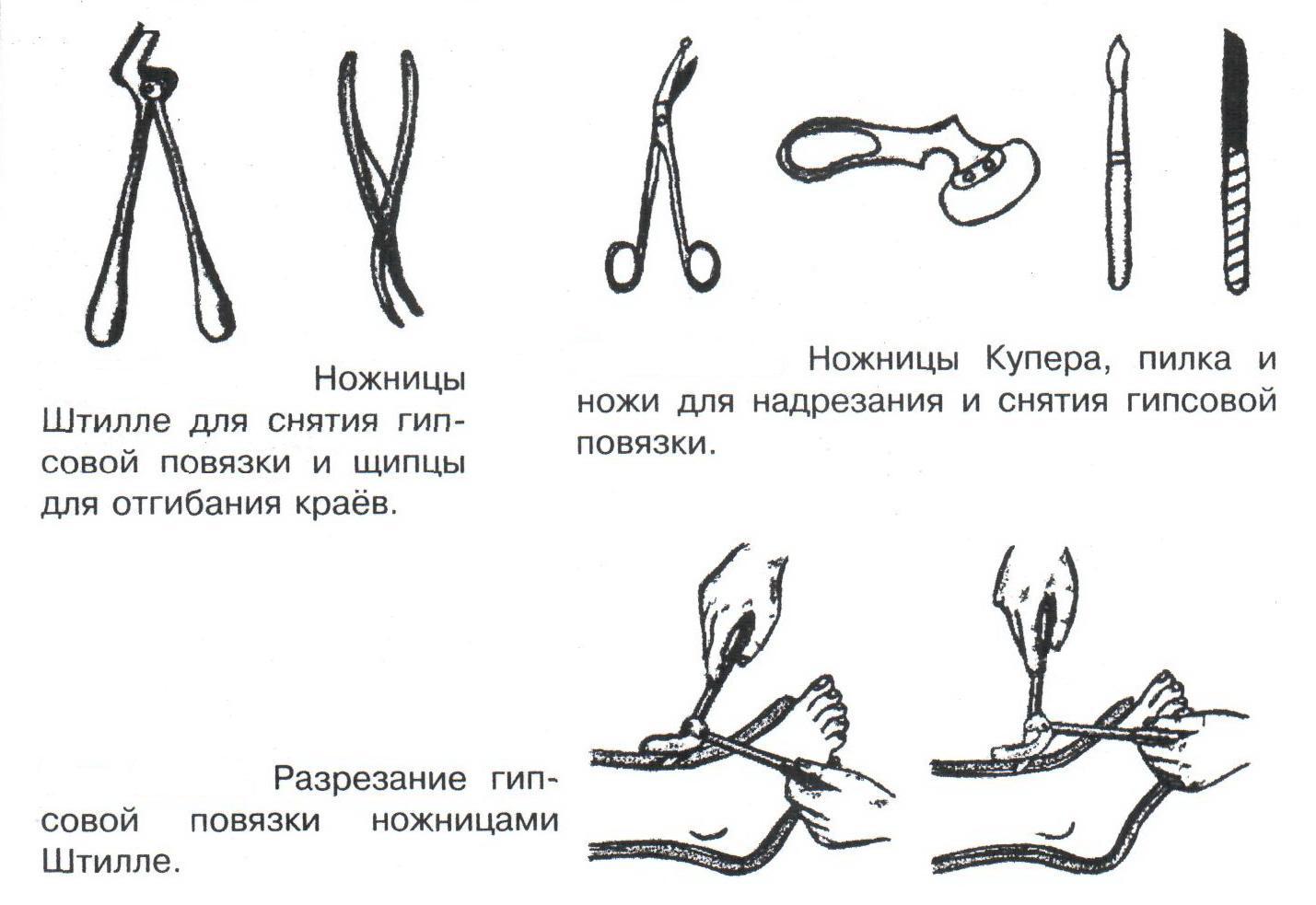 Инструменты и техника снятия гипсовых повязок