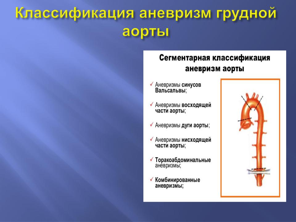 Презентация на тему: турбулентный кровоток вследствие дегенерации стенки